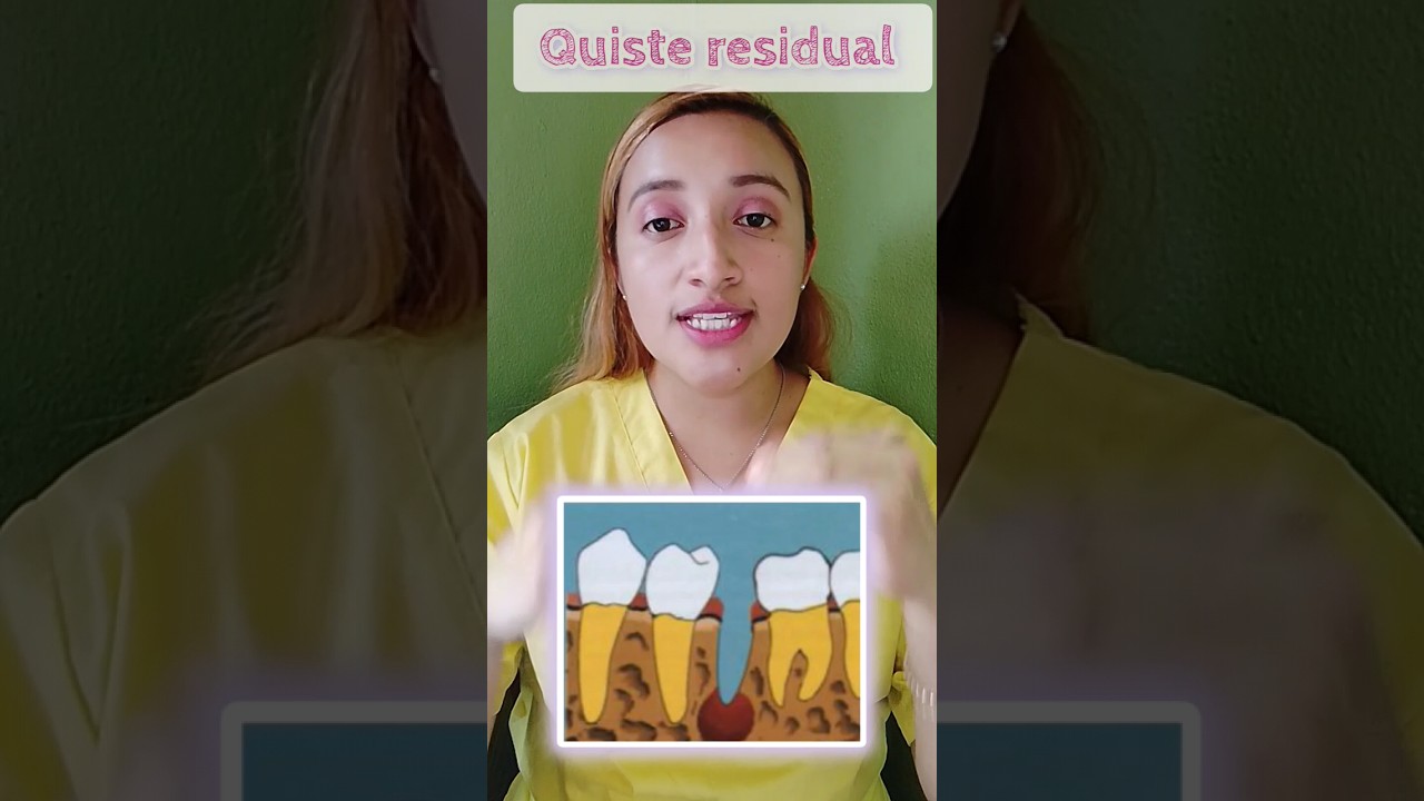 Quiste residual 🦷