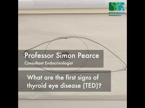 What are the first signs of thyroid eye disease (TED)? by Prof Simon Pearce #shorts #thyroid