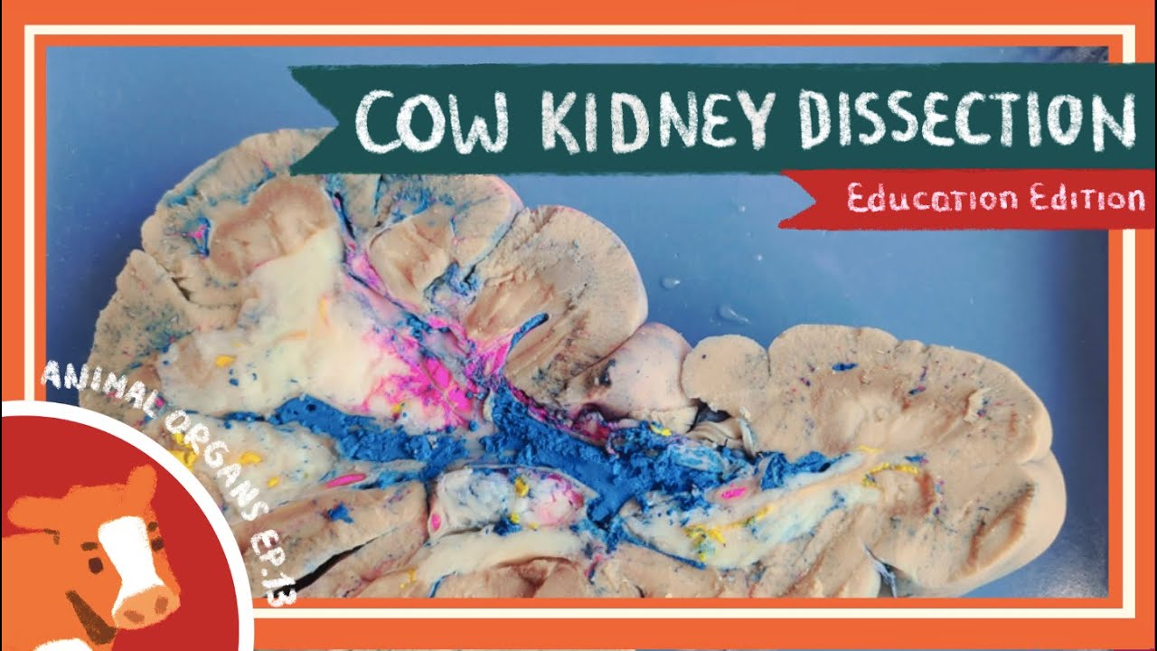 Kidney Dissection || A Man of My Kidney [EDU]