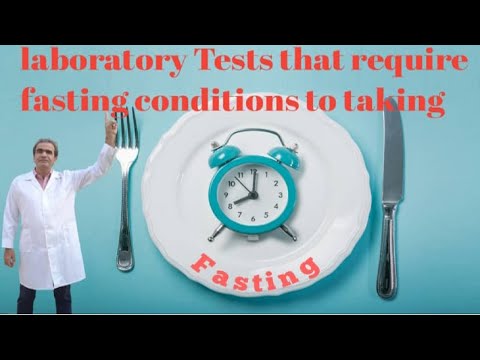 Laboratory Tests that require fasting conditions to taking