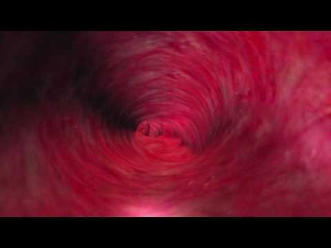 EDWARDS VIGILEO Central Oximetry Catheter