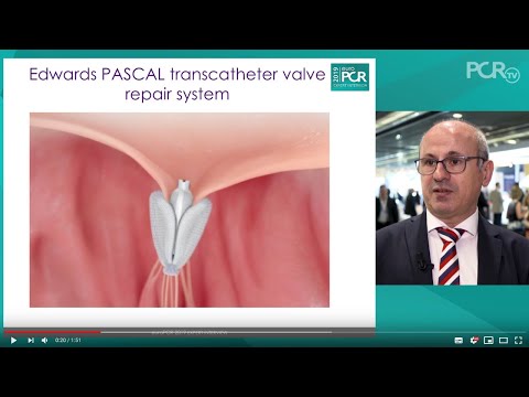 Advances in mitral repair therapy with the PASCAL device - EuroPCR 2019