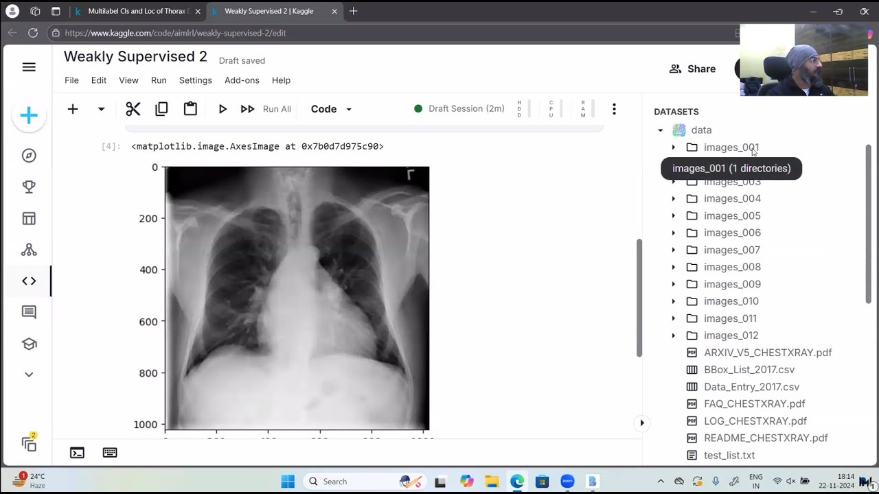 From Data to Diagnosis: Training a Multilabel CNN on Kaggle with Chest X-rays! (Part 2)
