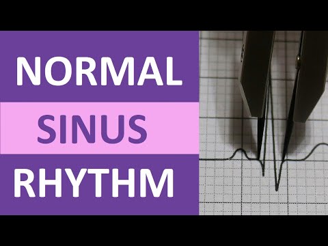 Normal Sinus Rhythm ECG/EKG Interpretation Nursing Review
