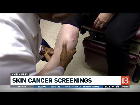 Check Up 13: Melanoma is deadliest form of cancer (9AM)