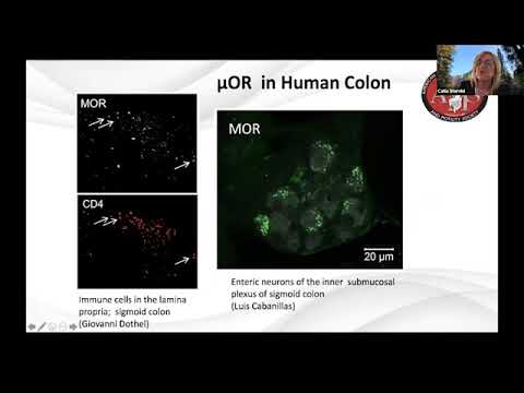 The endocannabinoid system and visceral pain: Its relevance to irritable bowel syndrome