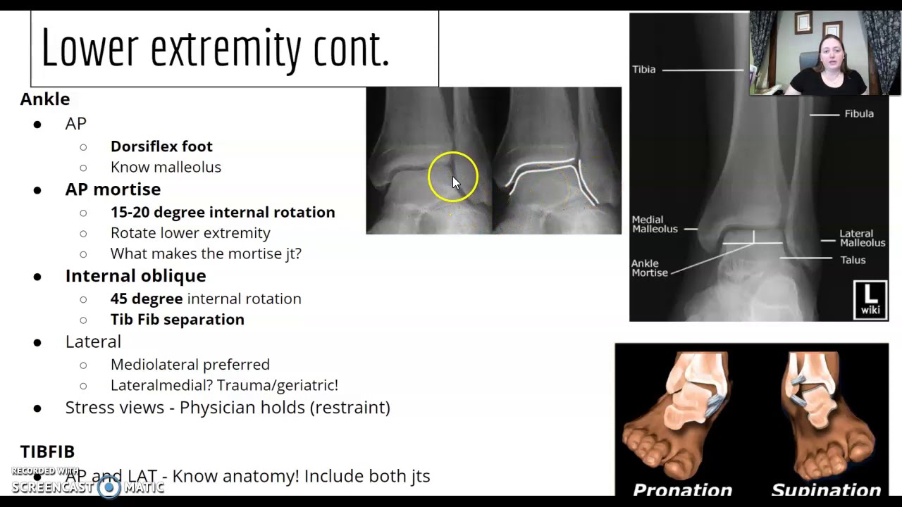 ARRT Procedures part # 7 - Lower Extremity