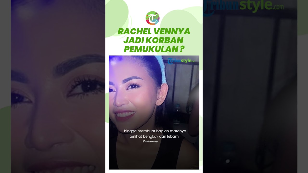 Alami Lebam di Bagian Mata, Rachel Venna Bak Jadi Korban Pemukulan, Cek ...