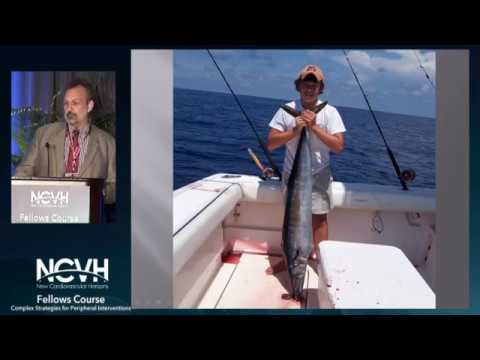 NCVH 2015 - Dr. Bunch Presentation - An Overview of Atherectomy Devices
