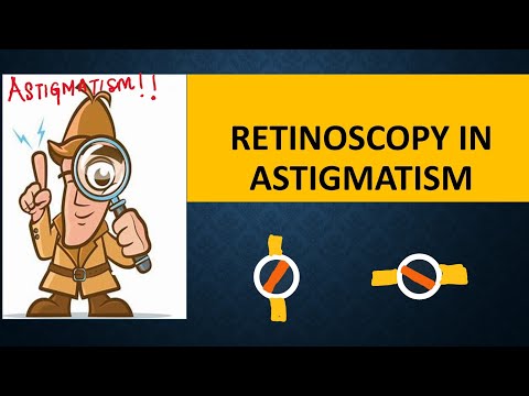 RETINOSCOPY in ASTIGMATISM | Break, intensity , brightness and skew | Straddling