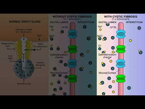 Cystic Fibrosis Sweat Glands