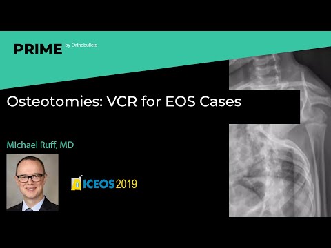 Osteotomies: VCR for EOS Cases - Michael Ruff, MD