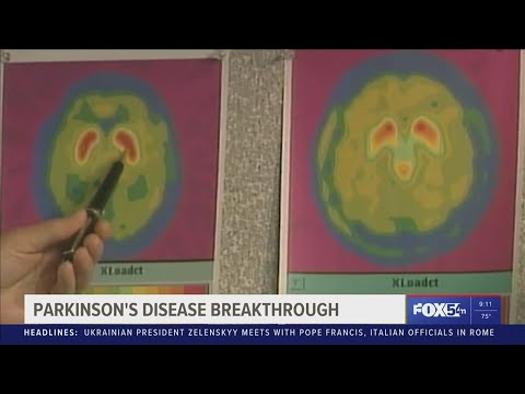 New test could help doctors detect Parkinson's Disease sooner