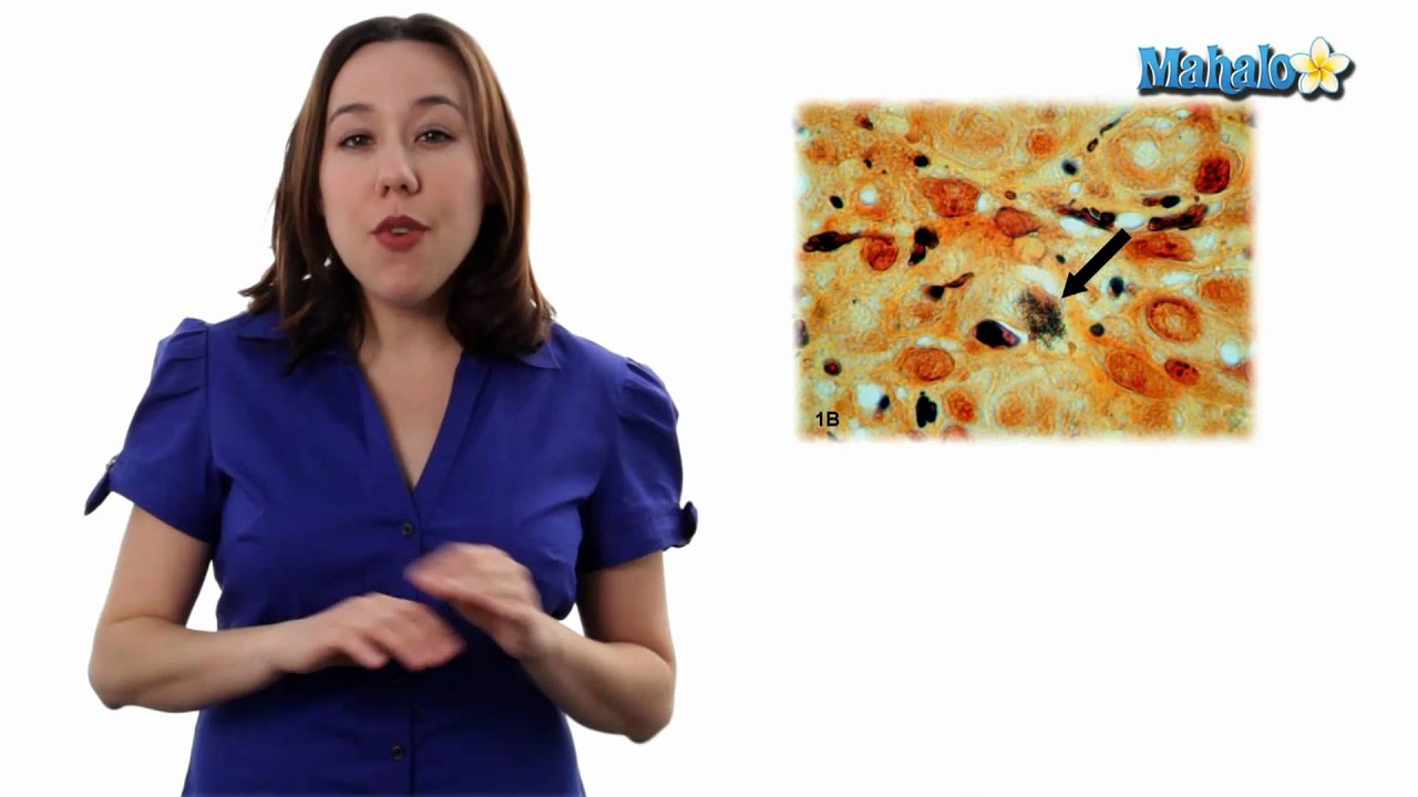 Learn Biology: Good Bacteria vs. Bad Bacteria