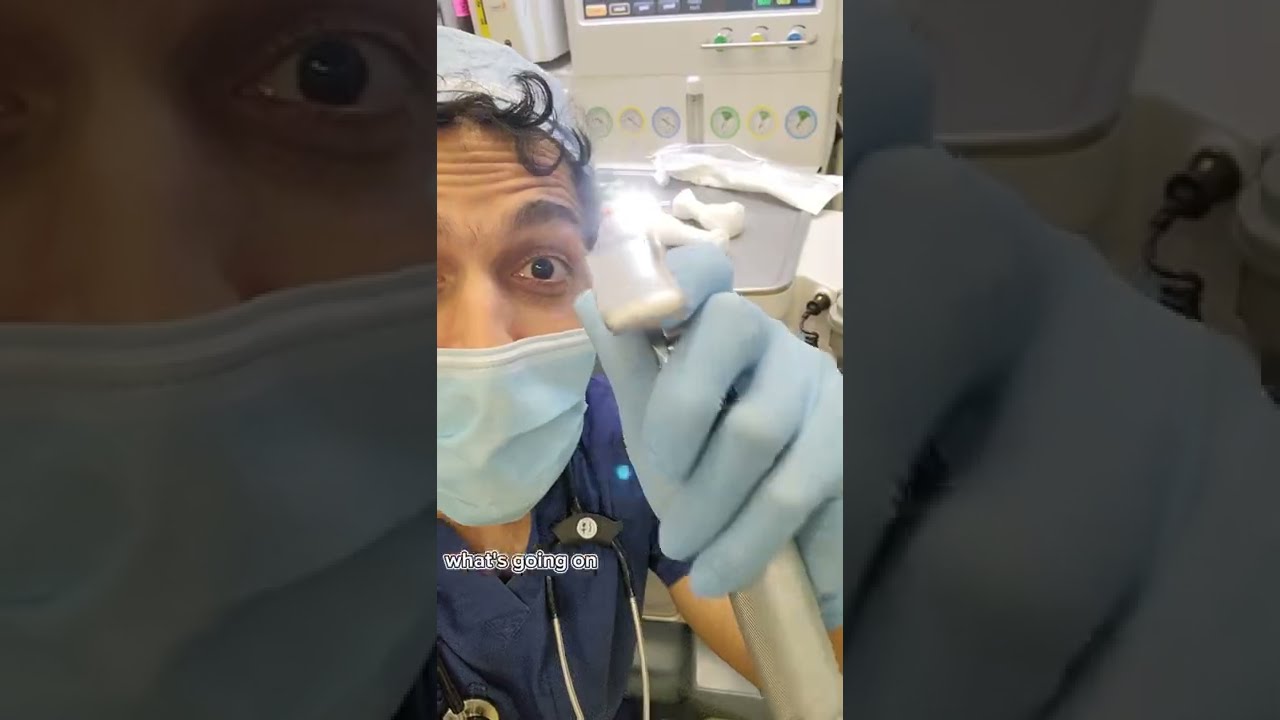 Spine Surgery Anesthesia Setup