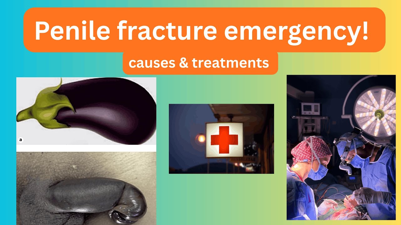 Can a Penis Break? Penile Fracture – Urologist Explains