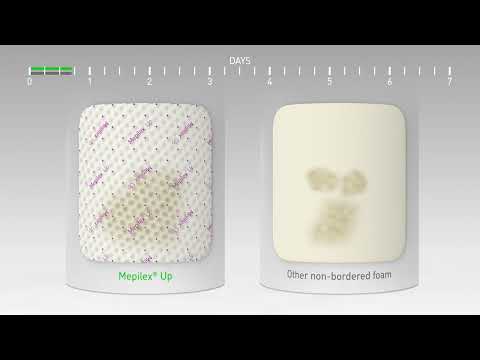 How does fluid spread in Mepilex Up?