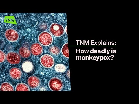 How deadly is monkeypox?