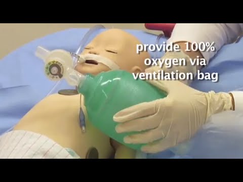 Endotracheal Tube Suctioning by M.J. Manning | OPENPediatrics