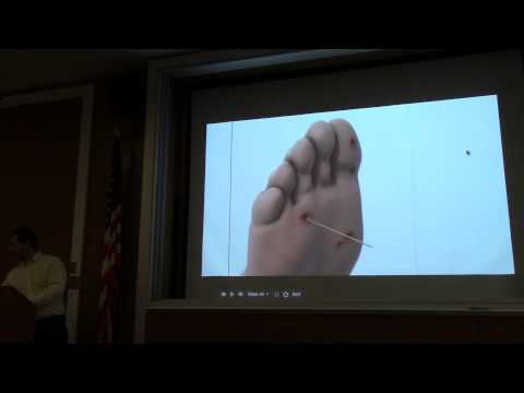 Dr. Zeccola Osteomyelitis Acute diagnosis, treatment and management