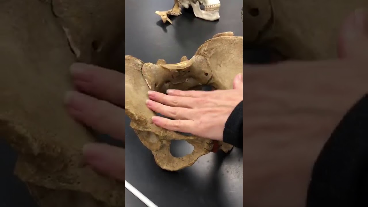 Pelvic Girdle FalseVsTruePelvis