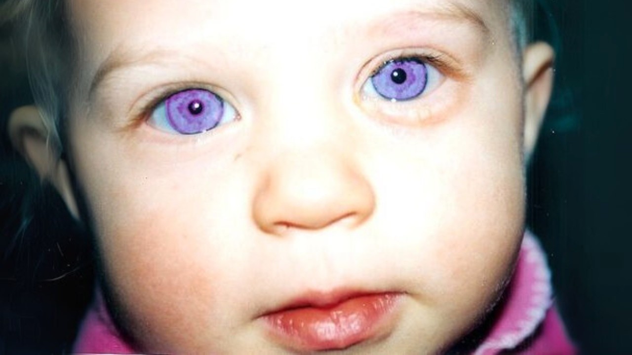 Purple Eyes – Rare Natural Eye Color Explained