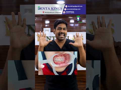 கிளிப் போட்டும் பல்லு நகரவே இல்லையே ஏன்? Phases of orthodontic treatment| Denta Kings| Tamil
