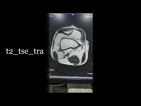 The hidden secrets of MRI knee protocols knee pain mri scan magnetic resonance imaging #beginners