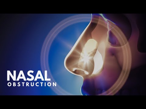 Nasal Obstruction with Dr. Latif Dharamsi, M.D.