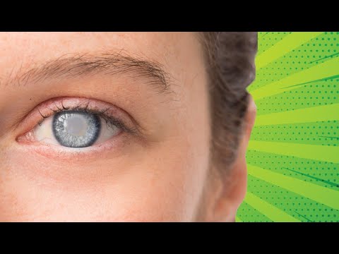 How Cataracts Affect Your Vision