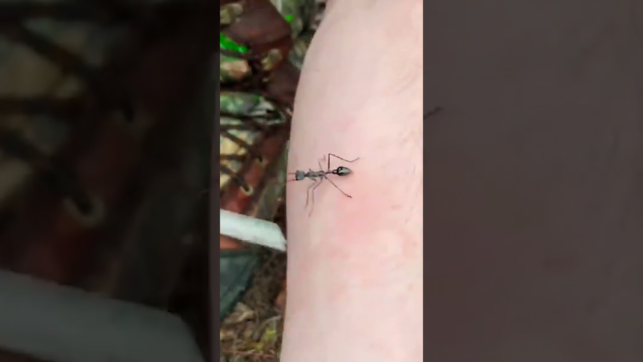 First Aid for Ant Bites #firstaid #ant