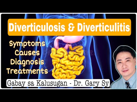 Diverticulosis and Diverticulitis- Dr. Gary Sy