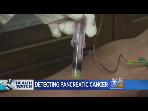 Experimental Blood Test May Detect Pancreatic Cancer In It's Early Stage