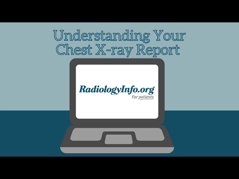 Understanding Your Chest X-ray Report