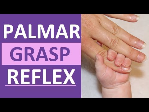Palmar Grasp Reflex Reaction Infant Newborn Pediatric Nursing Assessment