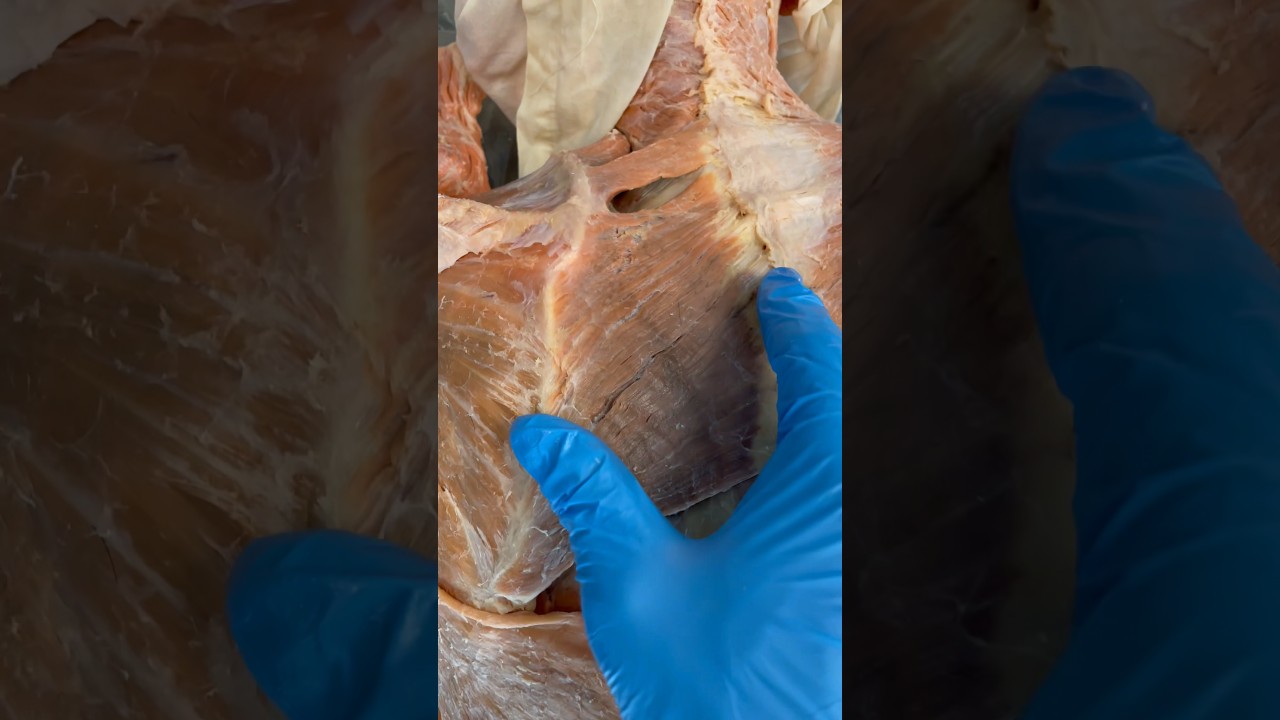 Working Out the Rhomboids!