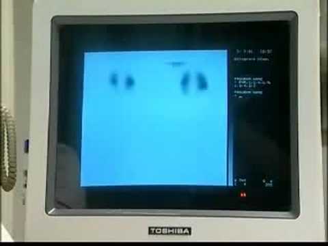 Ventilation quotient scan - Imaging in medicine (10/13)