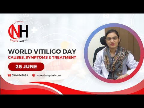 World Vitiligo Day - Causes, Symptoms and Treatment | Nazeer Hospital