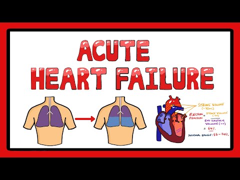 Acute Heart Failure - Types of Acute Heart Failure | Causes | Signs and Symptoms