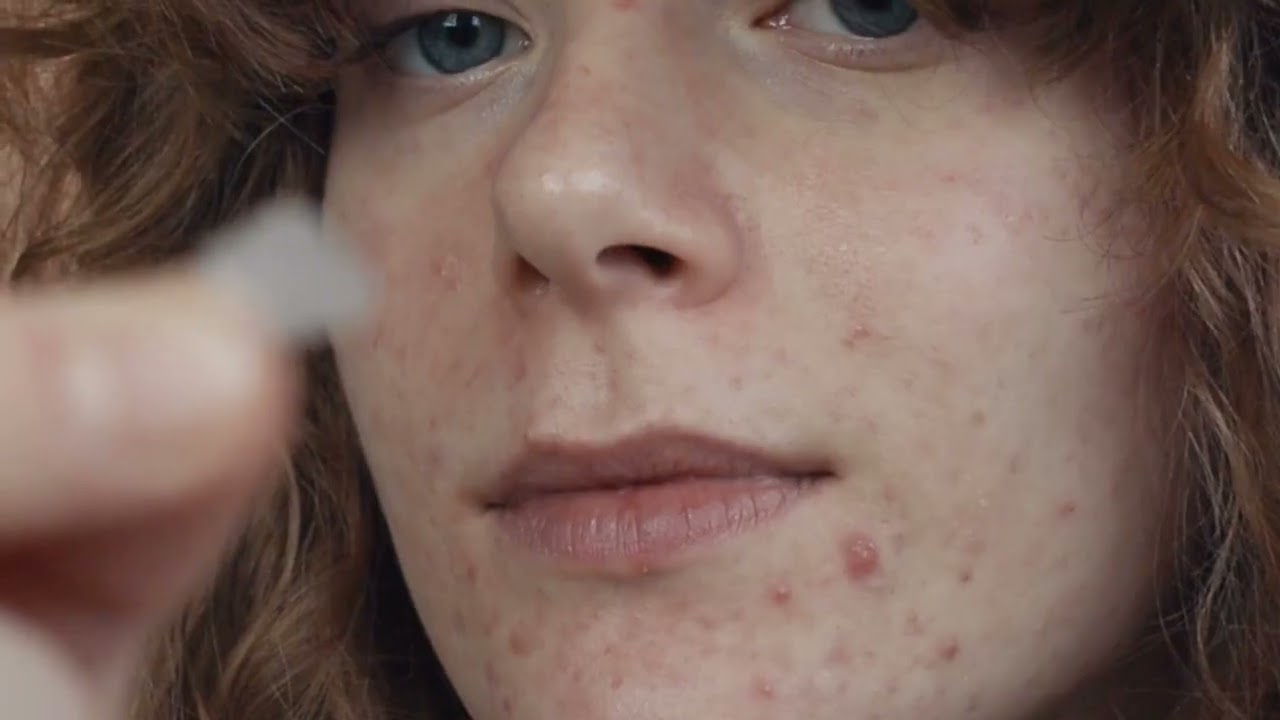 How to use Cloud Patch