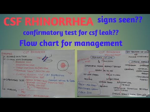 CSF Rhinorrhea