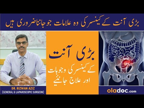 Bari Aant Ka Cancer Ka Ilaj- Colorectal Cancer In Urdu/Hindi - Blood In Stool- Colon Cancer Symptom
