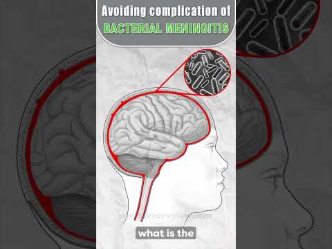 Avoiding complications of Bacterial Meningitis #usmle #internalmedicine #ccsstep3