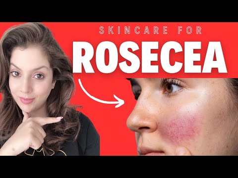 New Skincare Routine For Rosacea And Sensitive Skin!