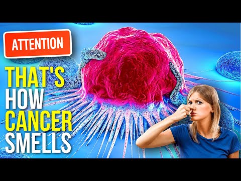 Here are THREE cancer scents that people don't pay attention to! How does oncology smell?