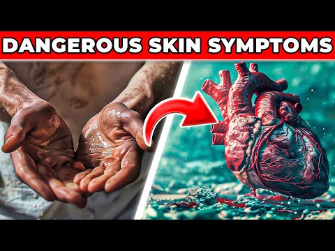 10 Alarming Skin Signs That Could Indicate Hidden Heart Disease