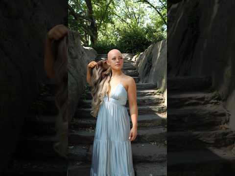 I love being bald, hair for me is an accessory, its like a cute hat