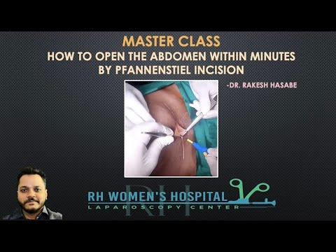 #103 : MASTERCLASS : HOW TO OPEN THE ABDOMEN WITHIN MINUTES BY PFANNENSTIEL INCISION.