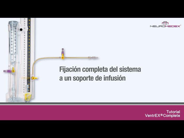 VentrEX® Complete EVD-System | Ventrex