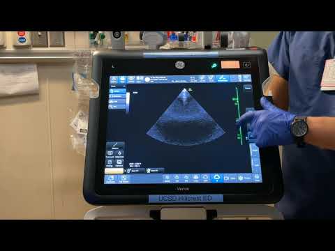 Introduction and How To | Searcy EM